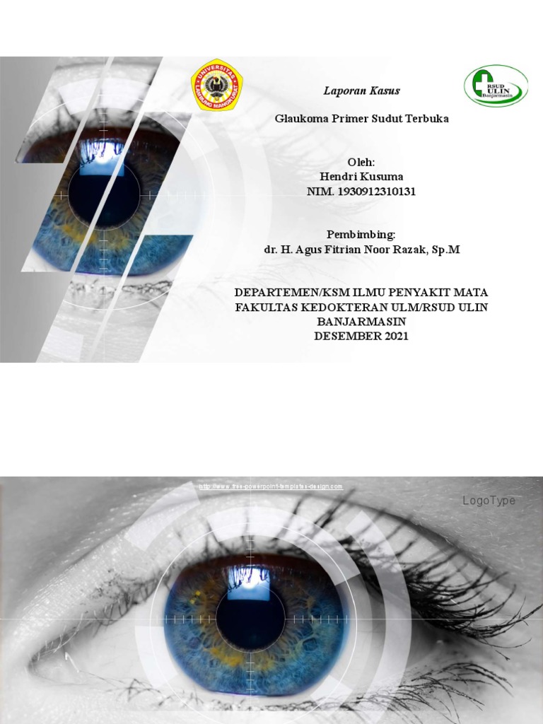 Lapsus Mata - Glaukoma Primer Sudut Terbuka - Hendri Kusuma | PDF