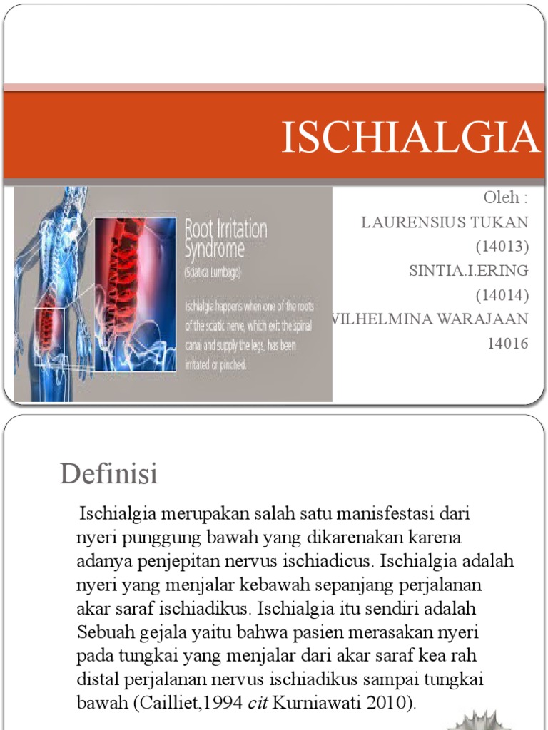 Ischialgia | PDF