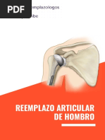 Protesis de Thompson Espanol SCECLE | PDF | Cirugía | Medicina CLINICA