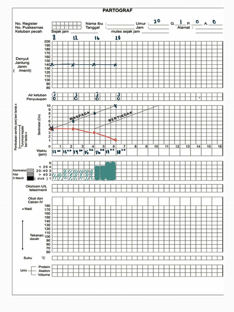 Partograph Tutorial 4 2018 2 | PDF
