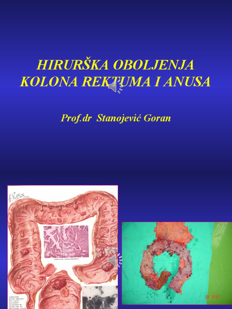 1 Hirurska Oboljenja Kolona Rektuma I Anusa | PDF