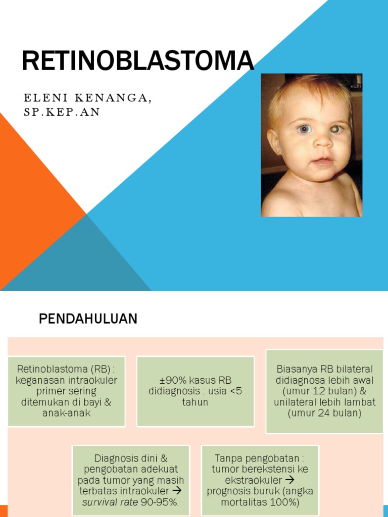 Retinoblastoma
