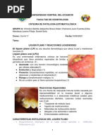 Revisión del Leucoedema Oral | PDF | Epitelio | Biología Celular)