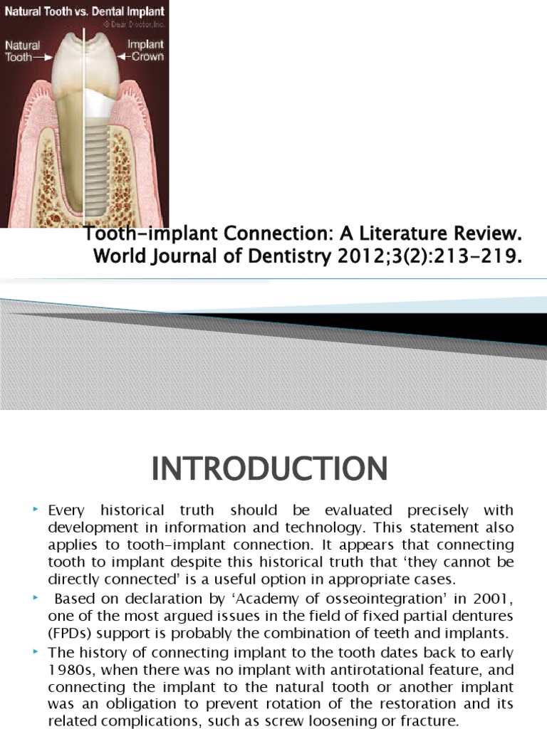 Tooth-Implant Connection | PDF | Dental Implant | Dentures