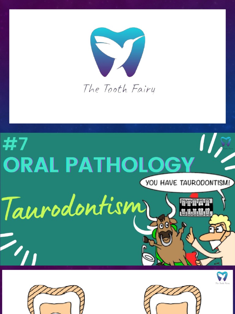 TAURODONTISM | PDF | Tooth | Health Sciences