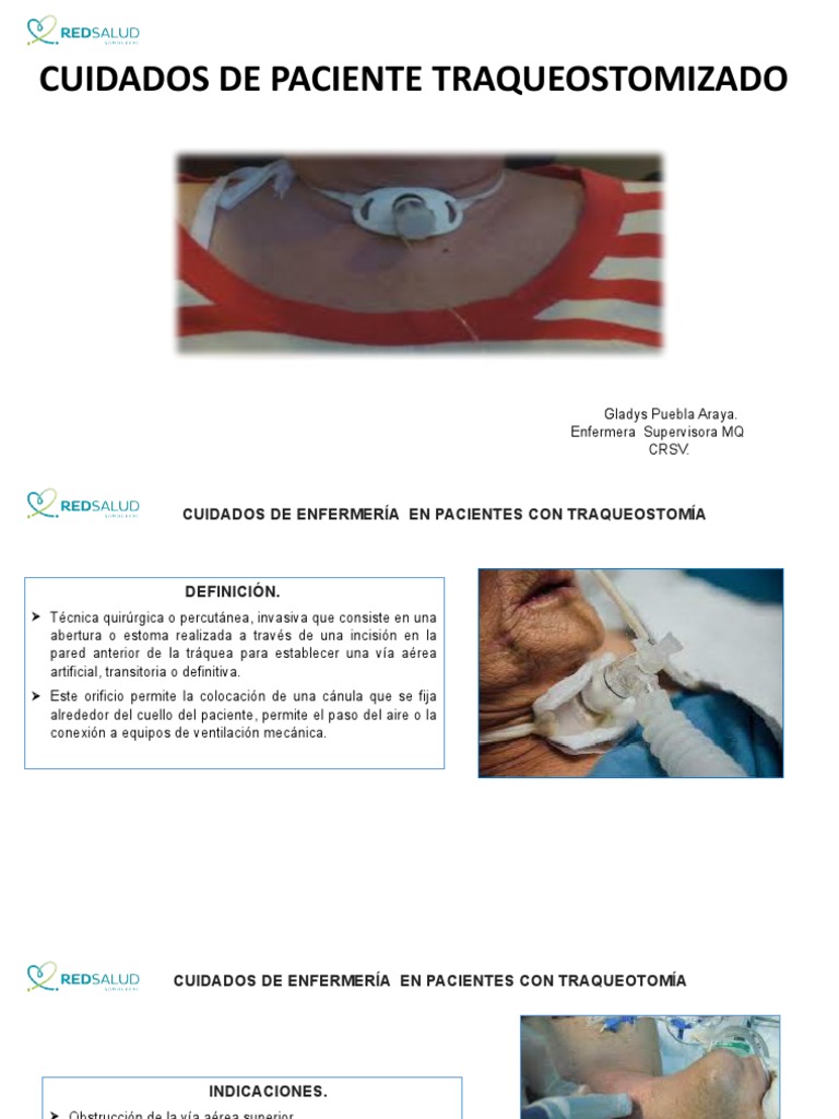 Cuidados TQT Gladys | PDF | Medicina CLINICA | Especialidades Medicas