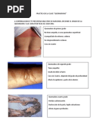 Proteus Ox19 en Las Reacciones Febriles Rickettsiosis | PDF ...