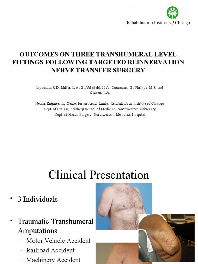 Outcomes On Three Transhumeral Level Fittings Following Targeted ...