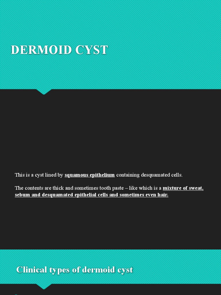 Dermoid Cyst | Download Free PDF | Human Nose | Clinical Medicine