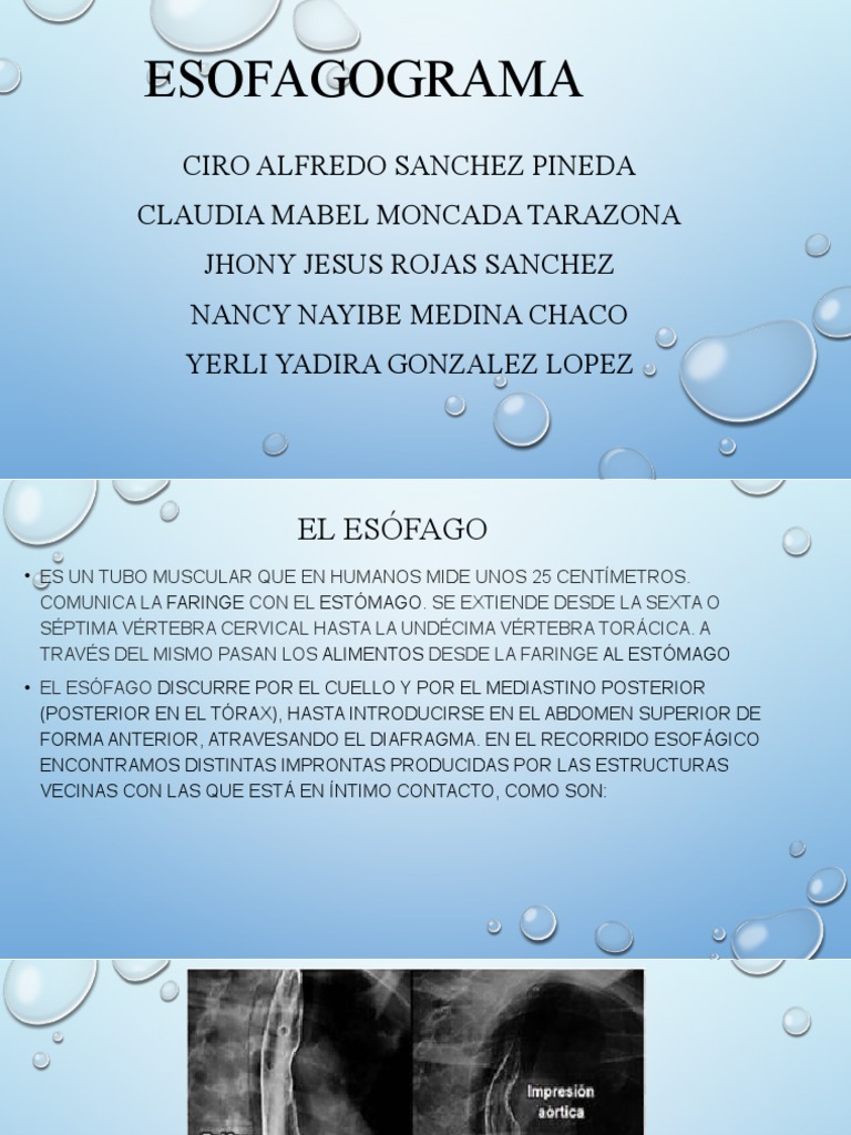 Esófagograma: Estudio y Procedimiento | PDF | Esófago | Enfermedades y ...