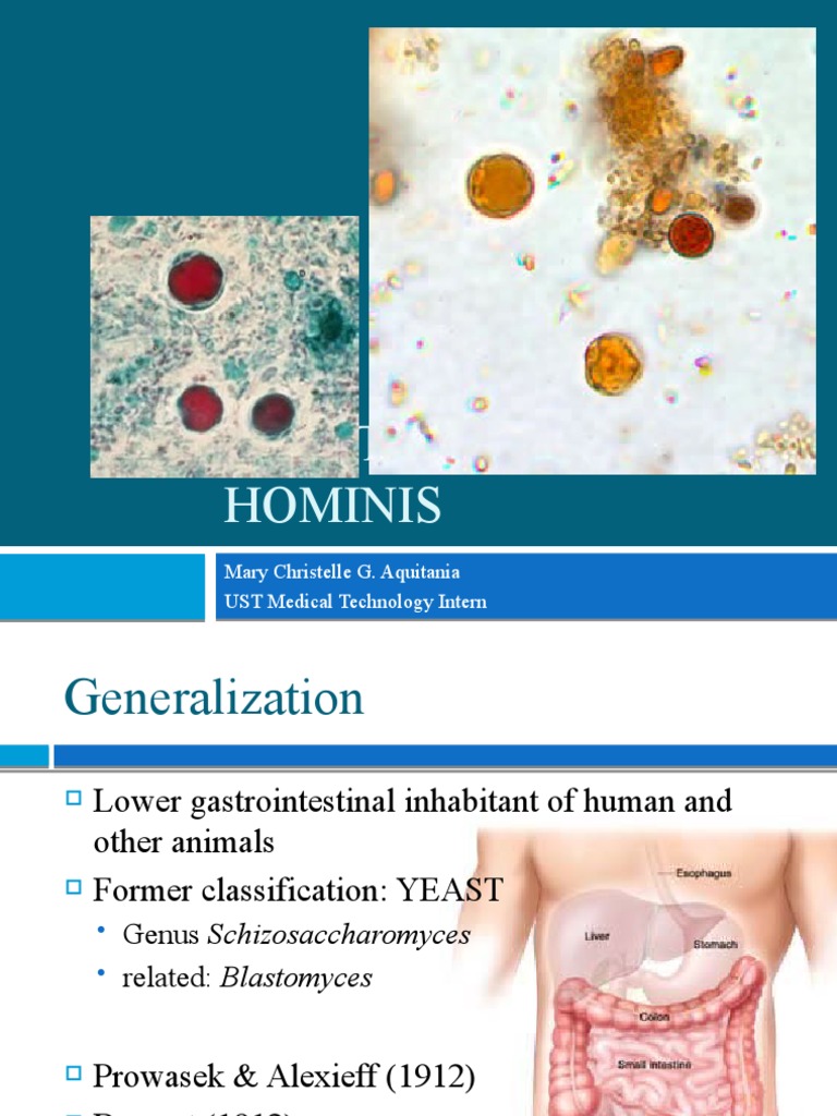 PARA - B. Hominis - Psuedomonas | PDF | Pseudomonas Aeruginosa ...
