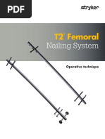 Acumed ES Surgical Technique Fibula Nail 2 ESFNA10 02 A | PDF