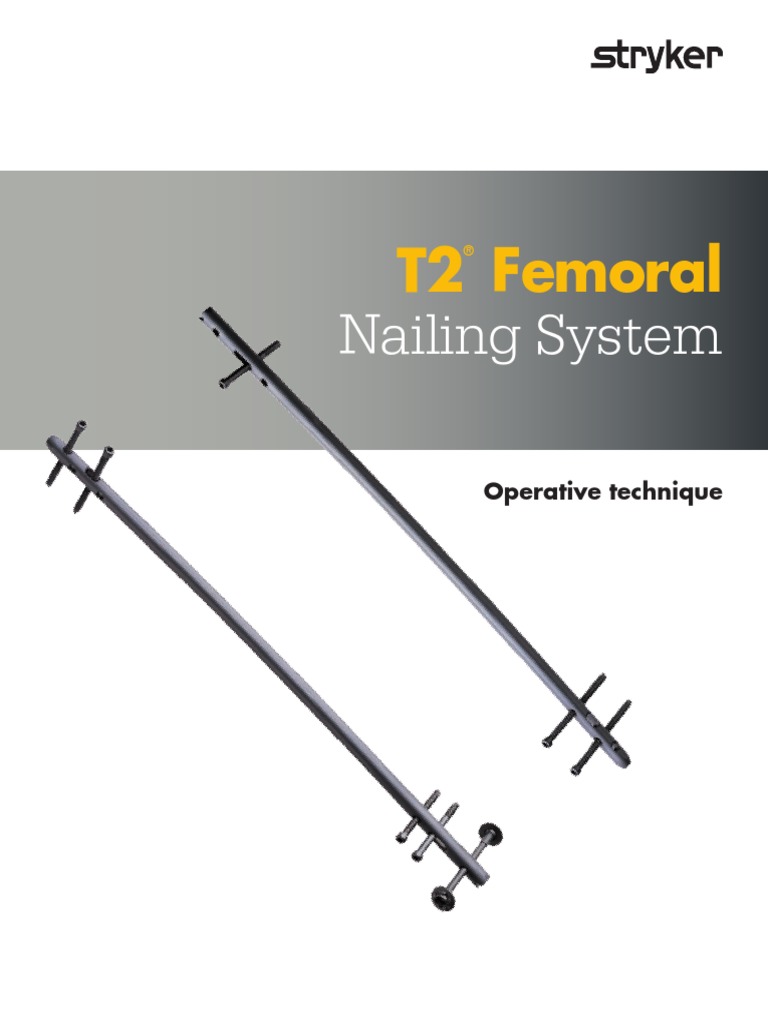Clou T2 Stryker 15 | PDF | Knee | Anatomical Terms Of Motion