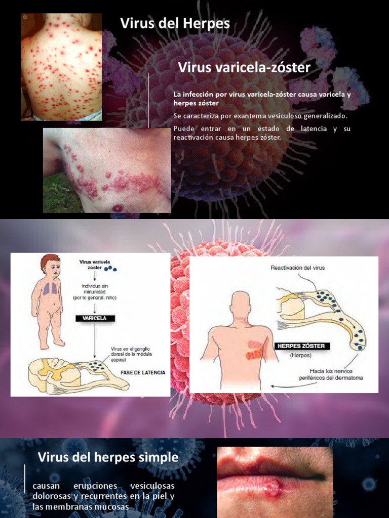 Infecciones Viricas | PDF