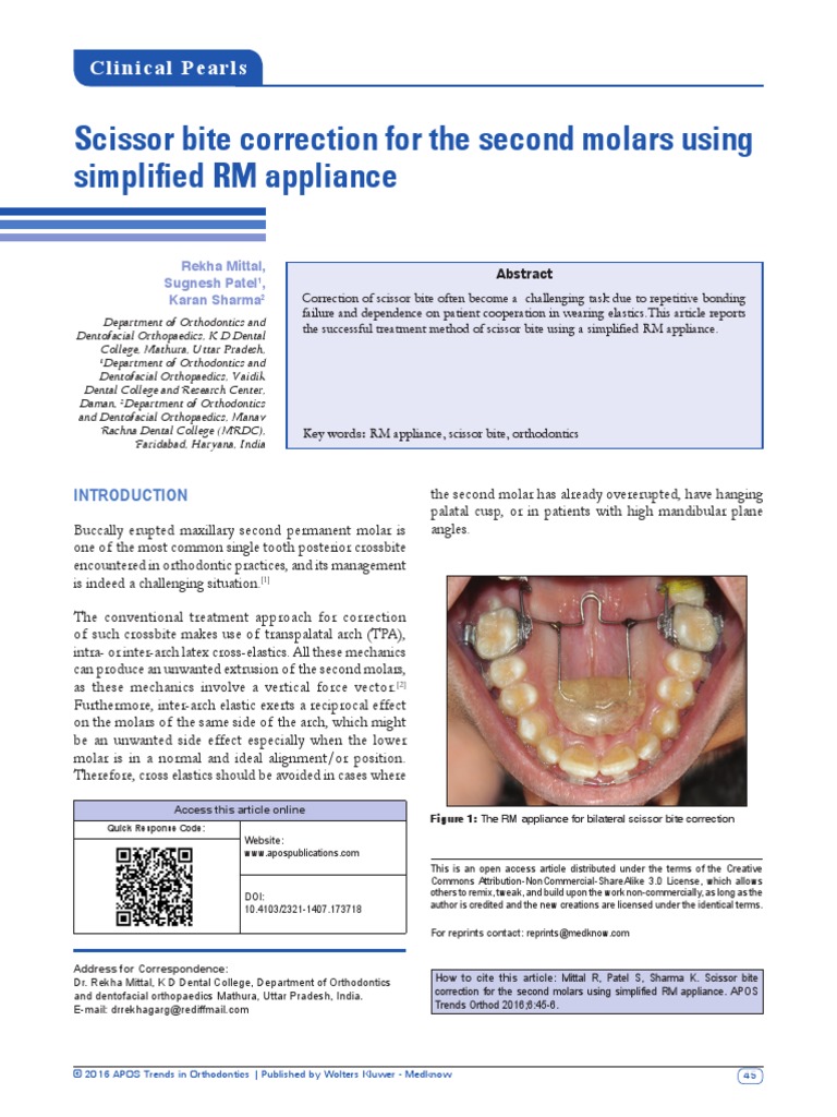 Scissor Bite Correction For The Second Molars Using Simplified RM ...