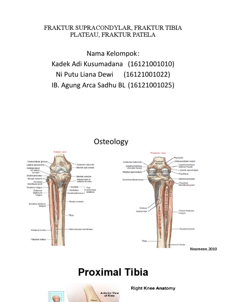 Fraktur Tibia Plateu | PDF