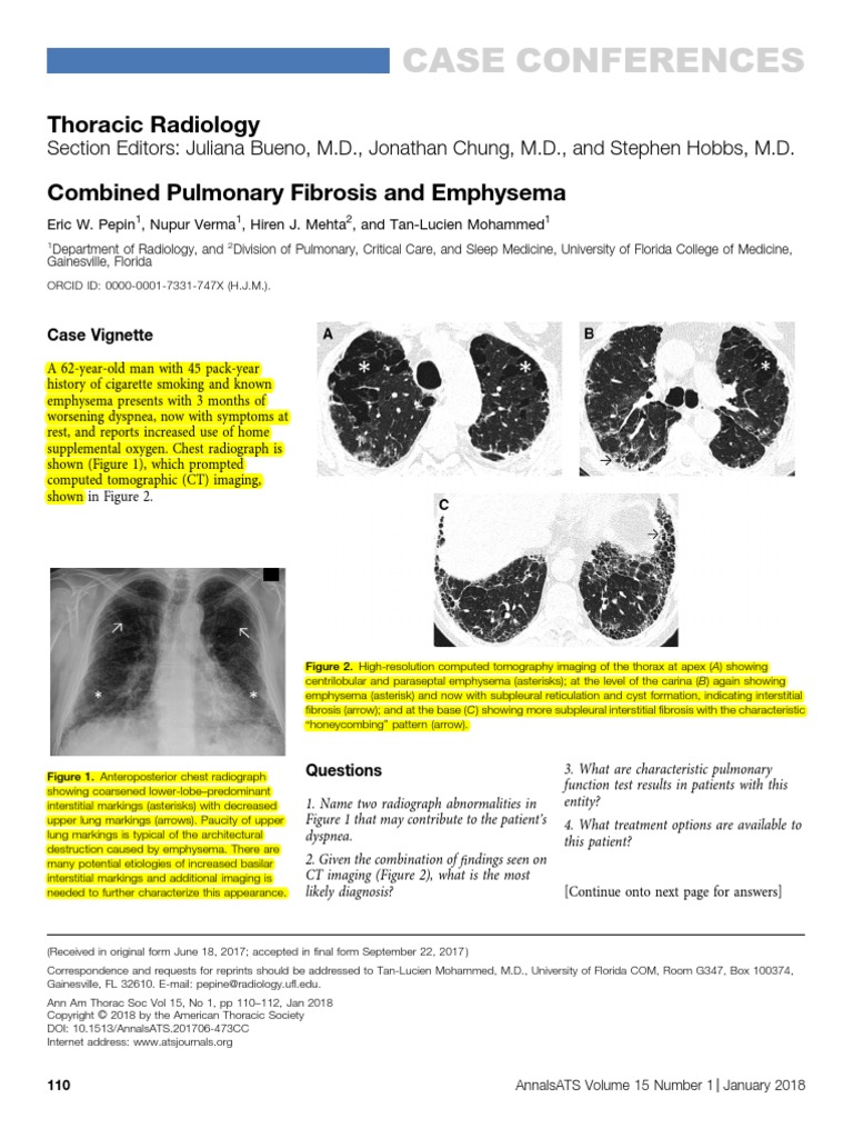 Case Emfisema Paru | PDF | Chronic Obstructive Pulmonary Disease | Lung