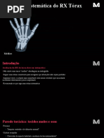 Variações Anatômicas do Seio Transverso | PDF | Seio