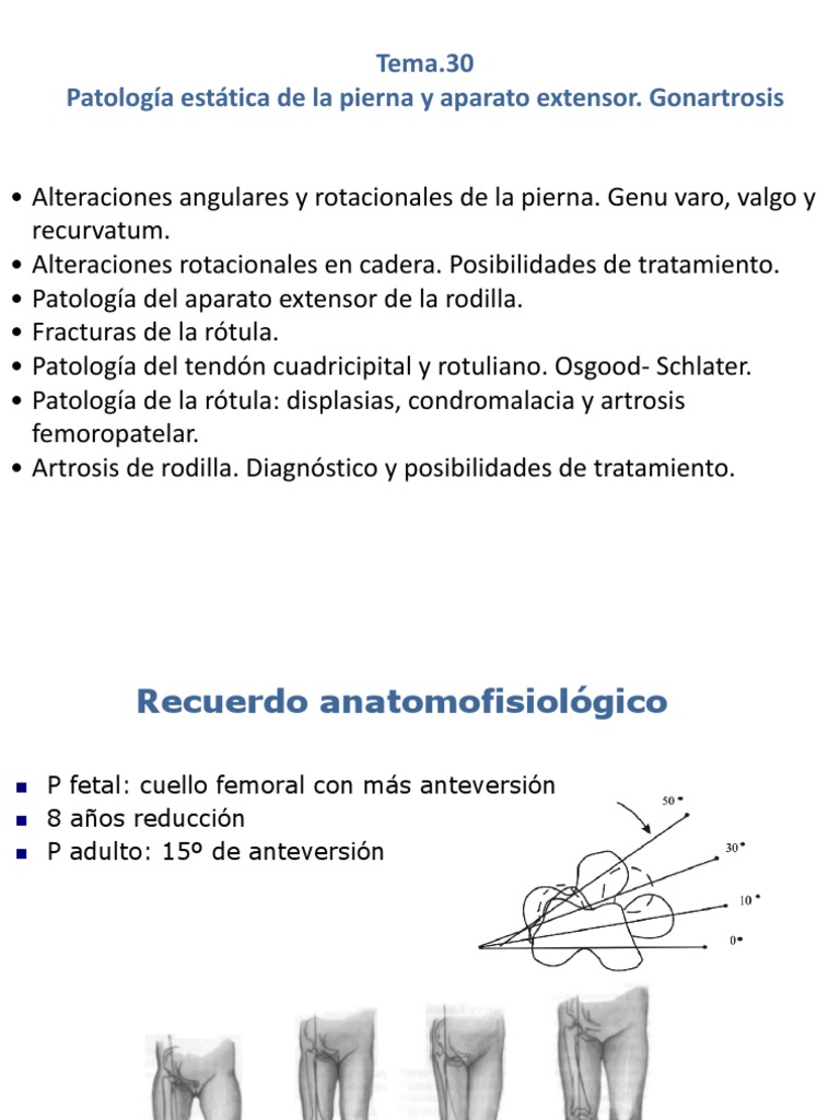 Tema 30 Patologia Estática de La Pierna y Aparato Extensor | PDF ...