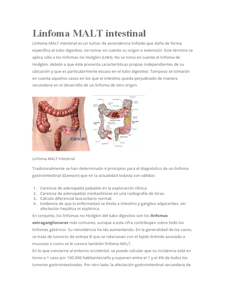 Linfoma MALT Intestinal | PDF | Linfoma | Intestino delgado