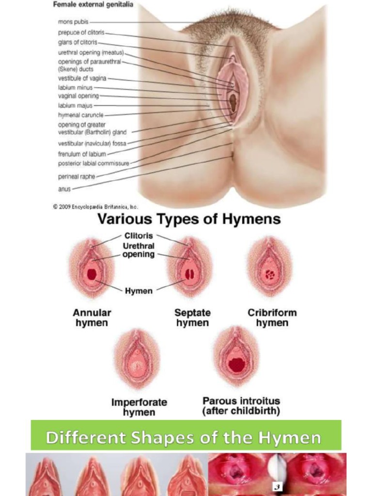 Hymen | PDF