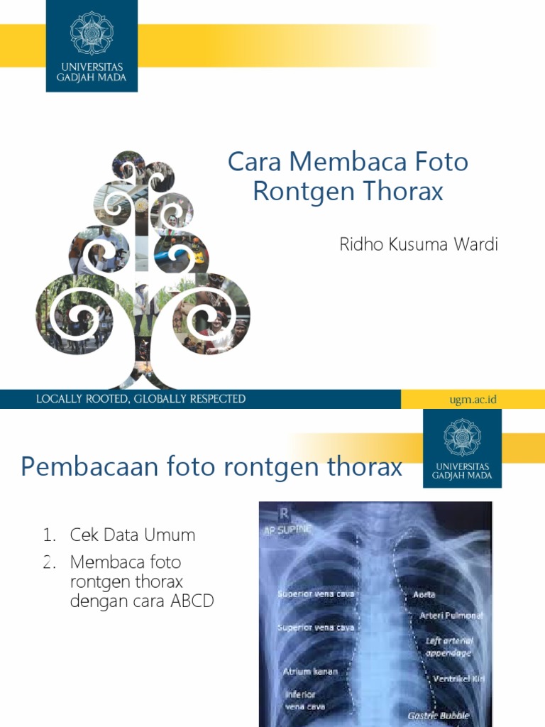 Ridho - Membaca Rontgen Thorax | PDF