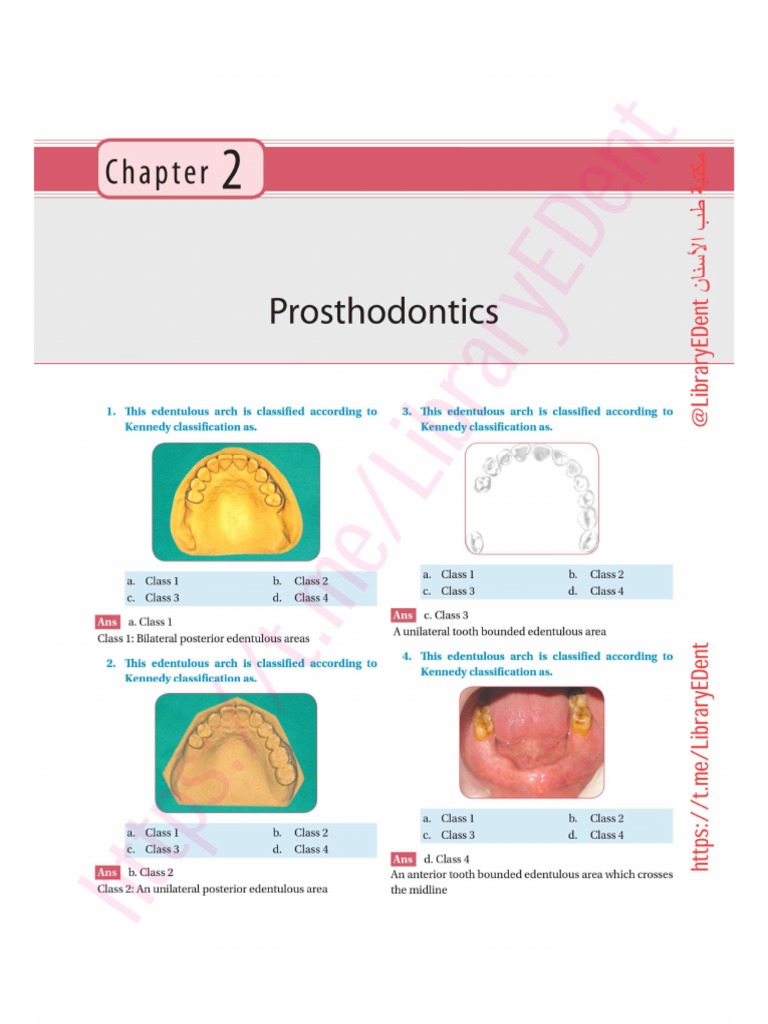 Prostho Set 1 A | PDF | Dental Implant | Dentistry Branches