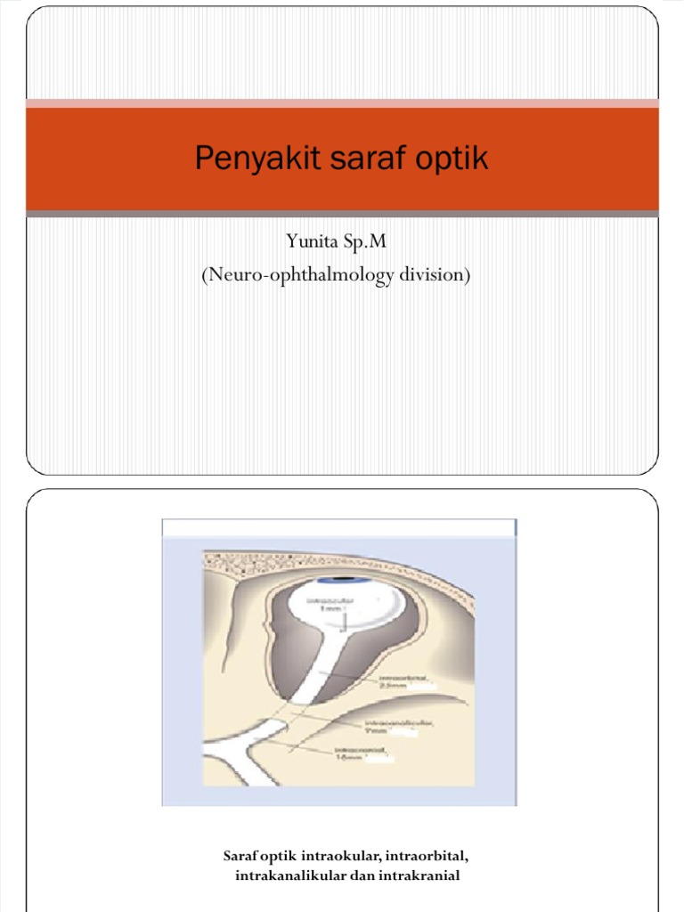 Dokumen - Tips - Penyakit Saraf Optik | PDF
