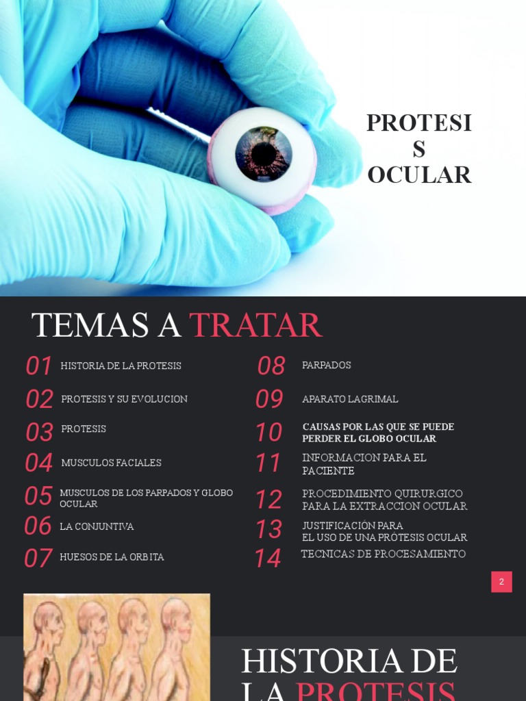Evolución y Función de Prótesis Oculares | PDF | Ojo humano | Ojo