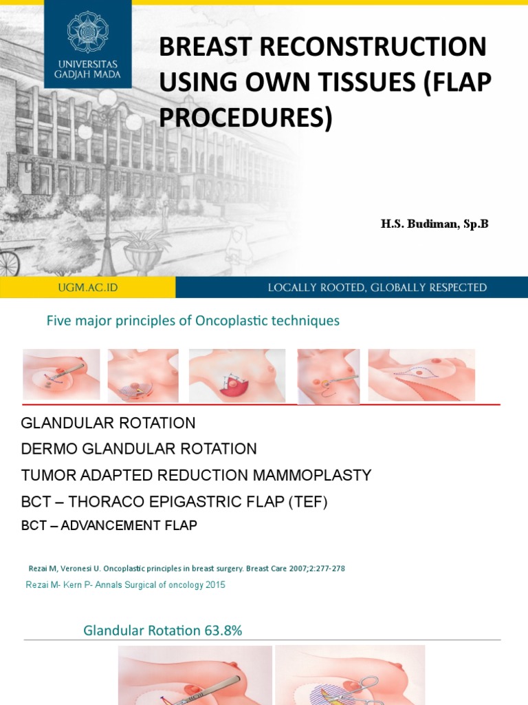 Breast Recosntruction Flap Procedure | PDF | Surgery | Surgical Specialties