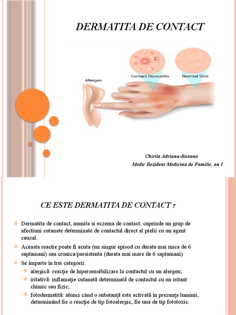 Dermatita de Contact Alergica | PDF