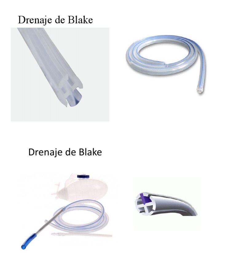 Drenaje de Blake | PDF