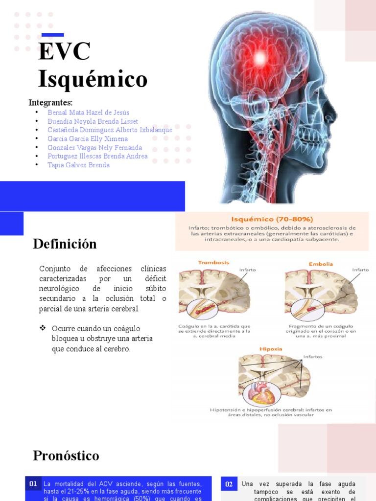 Evc Isquemico Expo | PDF | Carrera | Medicina CLINICA