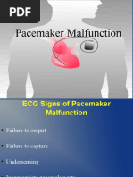 Pacemaker Generator Change Procedure Guide | PDF | Artificial Cardiac ...