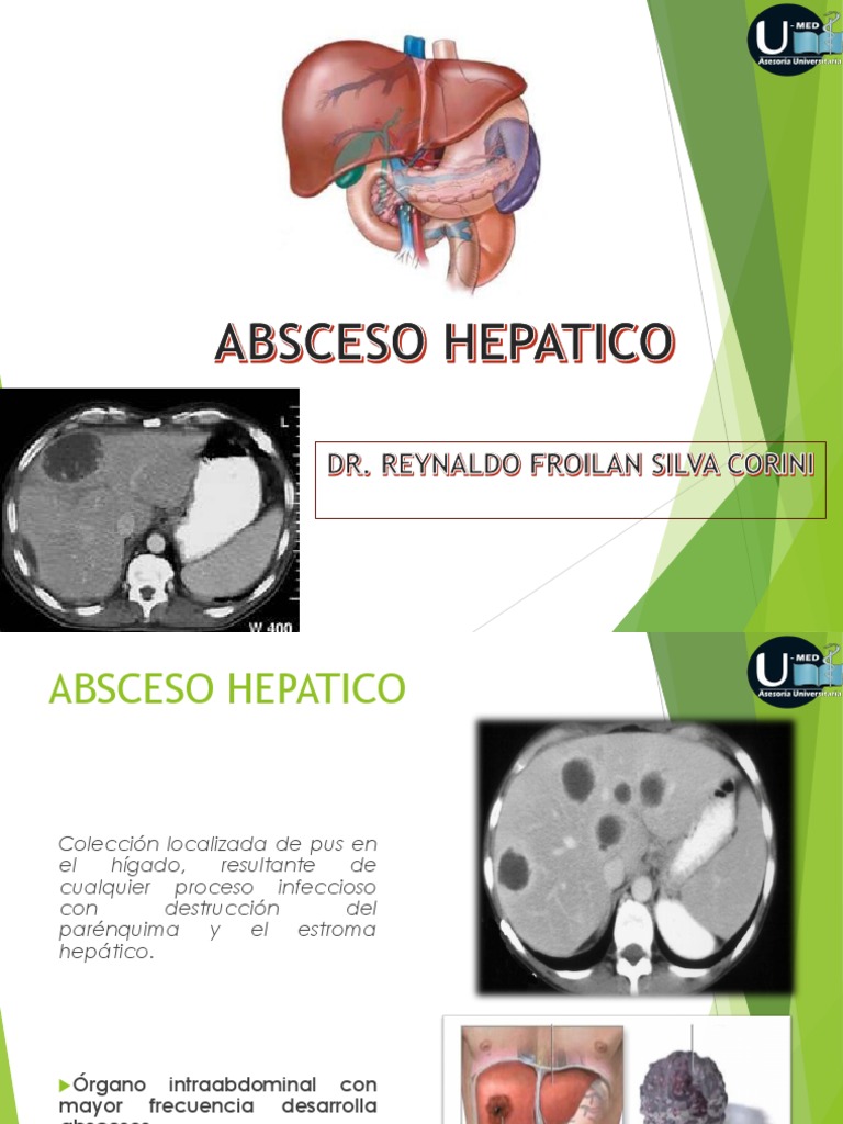 Abscesos Hepáticos | PDF