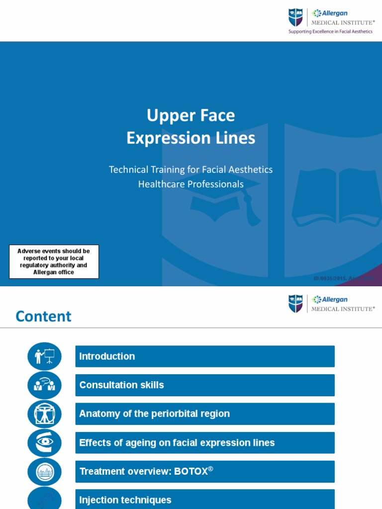 BOTOX Upper Face Expression Lines 2017 | PDF | Botulinum Toxin ...