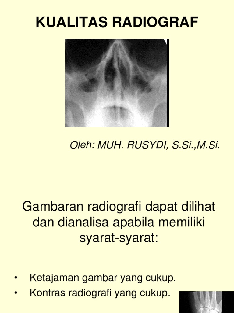 Kualitas Radiograf-1 | PDF
