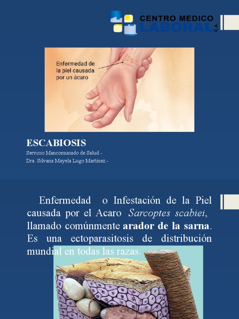 Escabiosis: Causas, Síntomas y Tratamiento | PDF | Inmunología ...