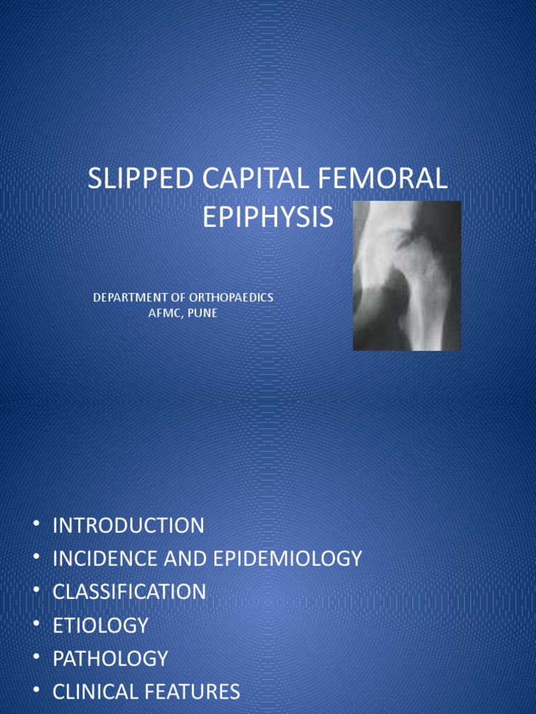 Slipped Capital Femoral Epiphysis | PDF | Anatomical Terms Of Motion ...
