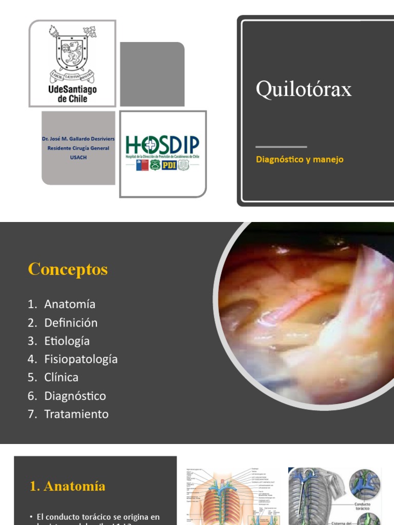 Quilotorax | PDF | Especialidades Medicas | Medicina CLINICA