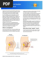 Constipation CHEO Handout | PDF | Constipation | Human Feces