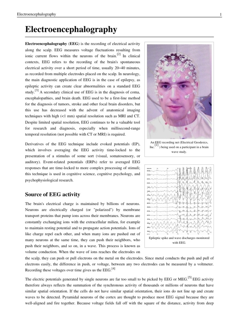 Electroencephalography: Source of EEG Activity | PDF ...