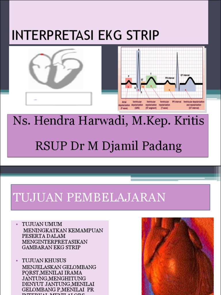 Interpretasi Ekg-1 | PDF
