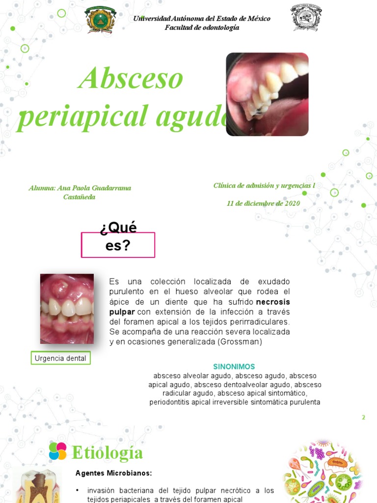 Absceso Periapical Agudo: Diagnóstico y Tratamiento | PDF | Odontología ...