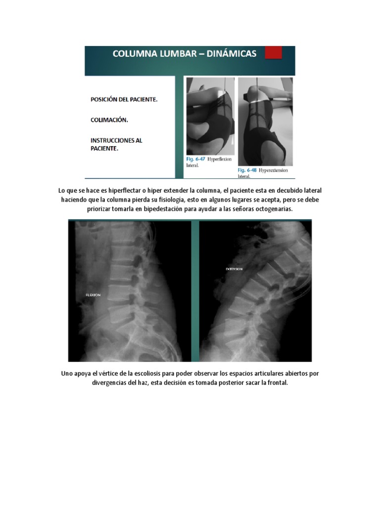 Lumbar y Columna Total 2 | PDF | Vértebra | La columna vertebral