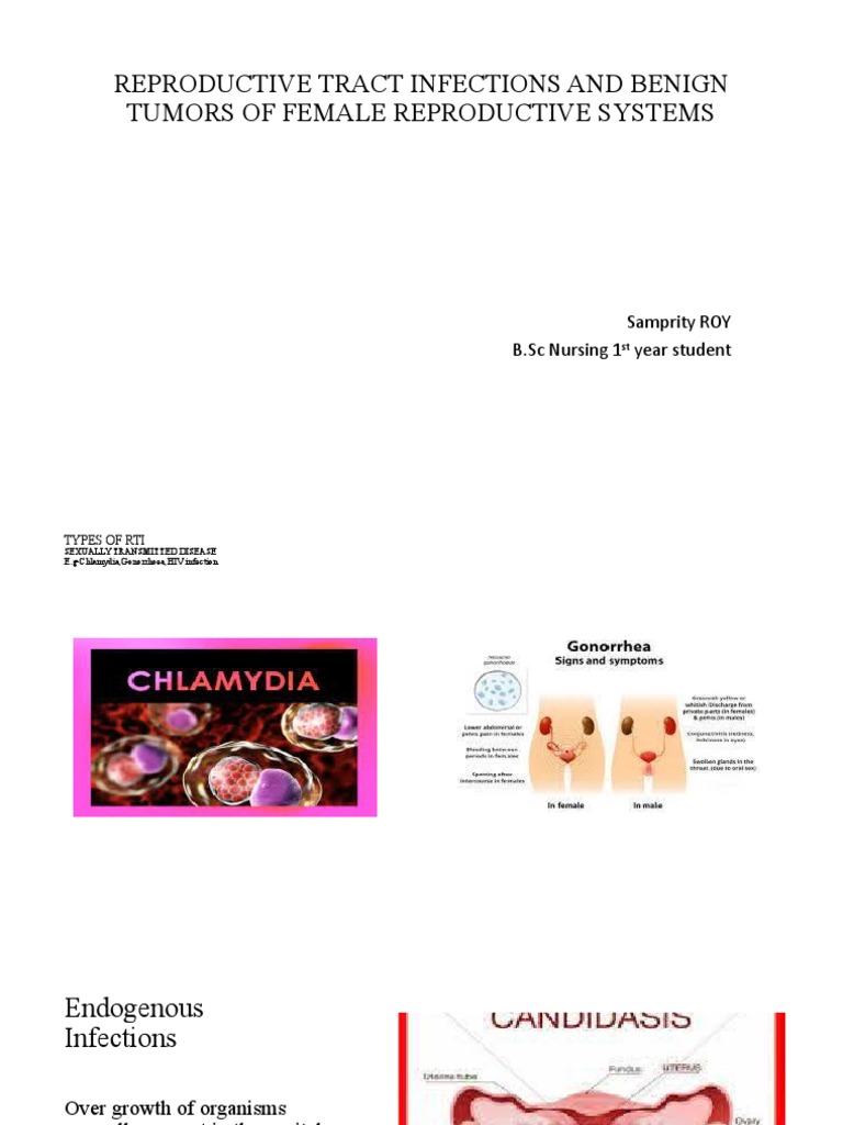 Reproductive Tract Infections Overview | PDF | Uterus | Vagina