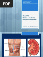 Protocolo FAST y líquido abdominal | PDF | Ultrasonido médico | Pelvis