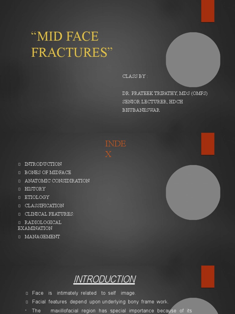"Mid Face Fractures": Class By: Dr. Prateek Tripathy, Mds (Omfs) Senior ...