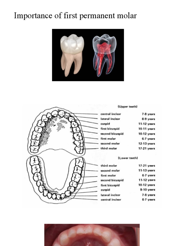 Importance of 1st Permanent Molar | PDF | Tooth | Clinical Medicine