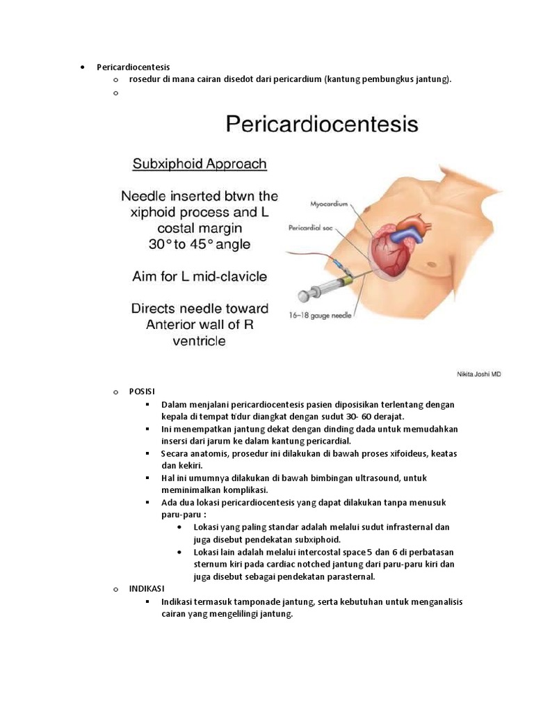 Pericardiocentesis | PDF